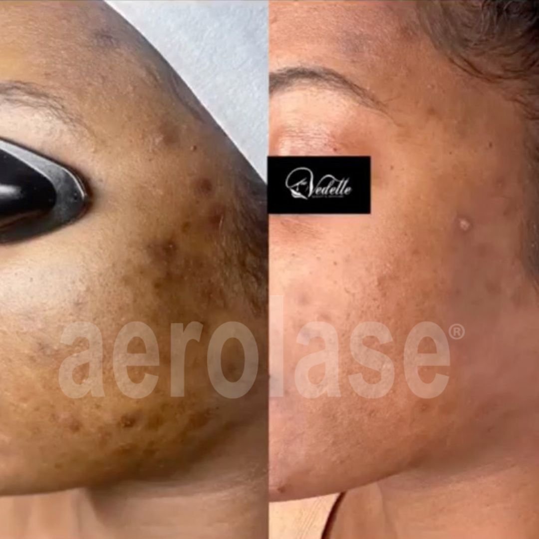 GLo and Tell - Blog | Loren Ashley Skin Clinic